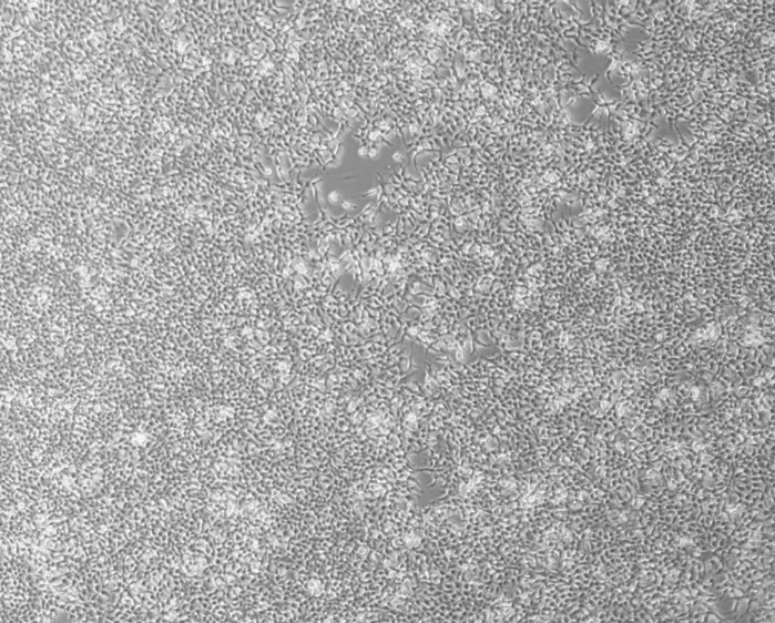 细胞攻略 | 293[HEK 293](人胚肾细胞)细胞培养教程-公司新闻-武汉尚恩生物技术有限公司