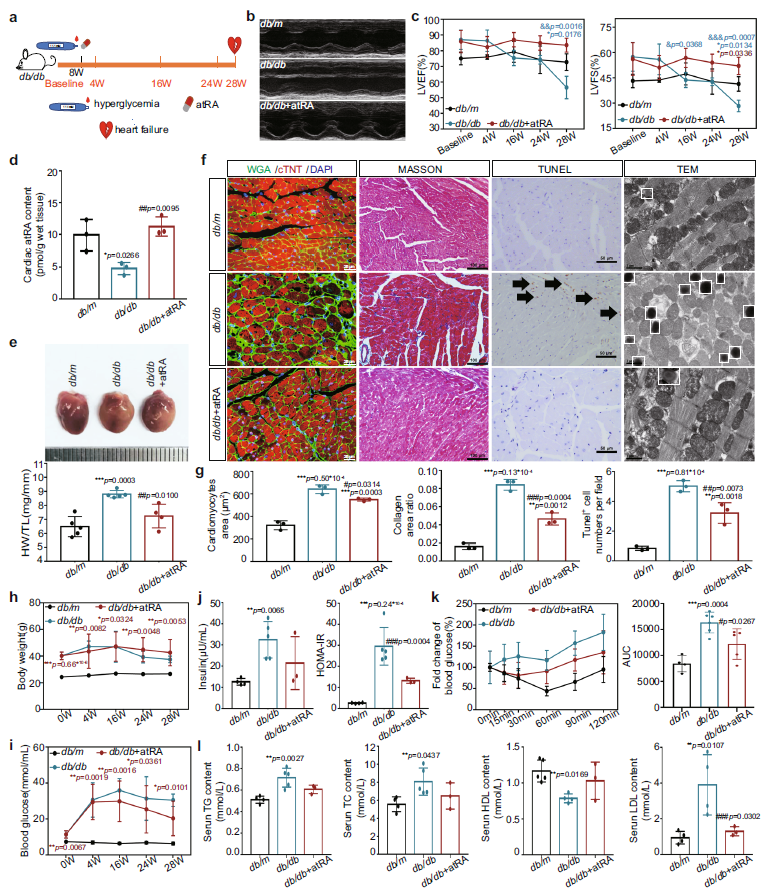 IF=17.694|糖尿病性心肌病靶标新发现—视黄醇脱氢酶10-公司新闻-汉恒生物科技（上海）有限公司