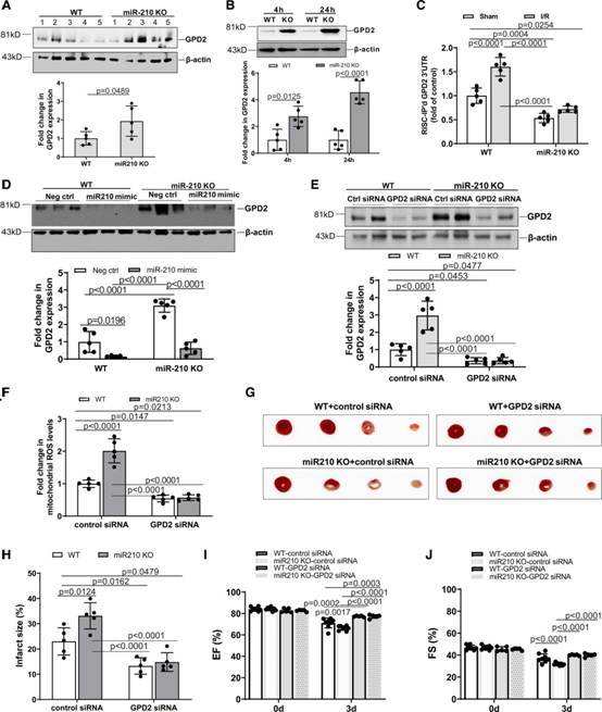 MicroRNA-210在心肌梗死中控制线粒体代谢并保护心脏功能 - 企业动态 - 丁香通