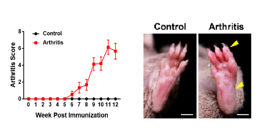 关于RA动物模型探索类风湿性关节炎发病机制与治疗，你一定要知道！_公司新闻_丁香通