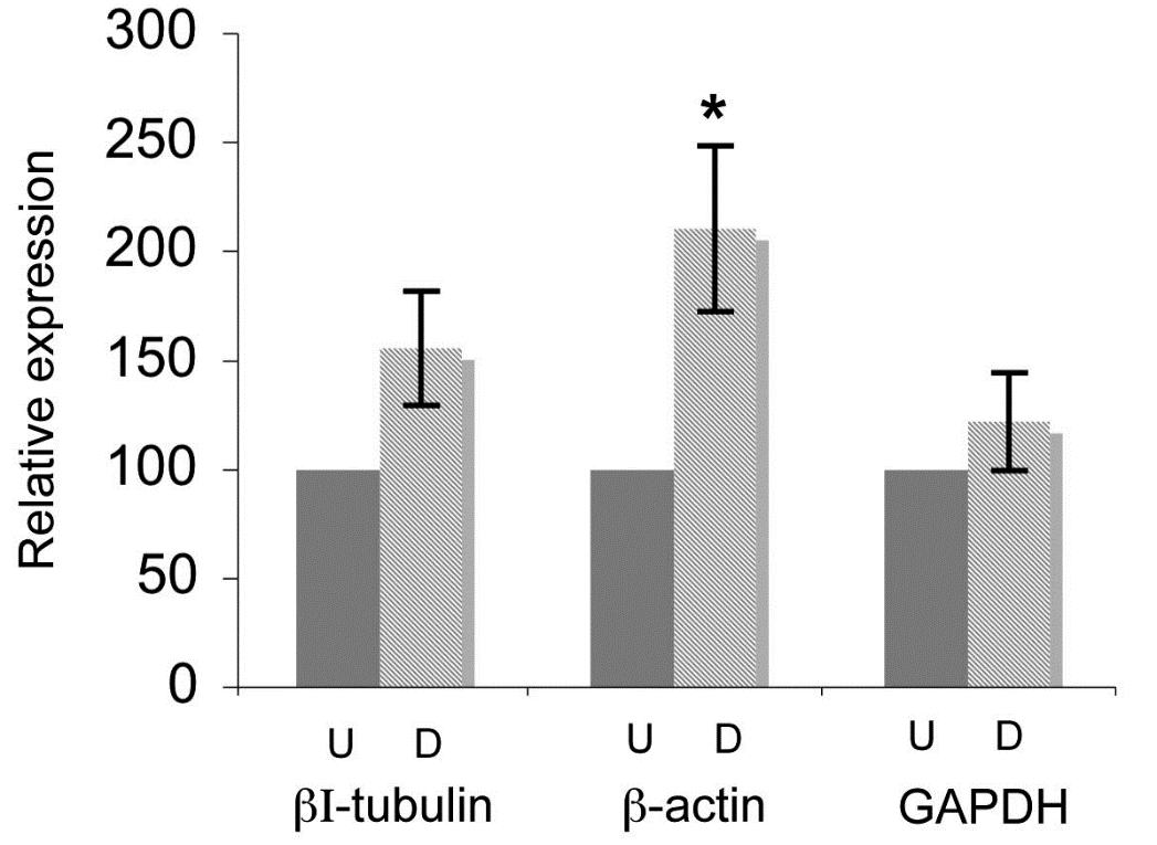 WB 高手必知：原来这些实验内参最优不是 β-Actin 或 GAPDH-公司新闻-伯乐生命医学产品（上海）有限公司 Bio-Rad Laboratories