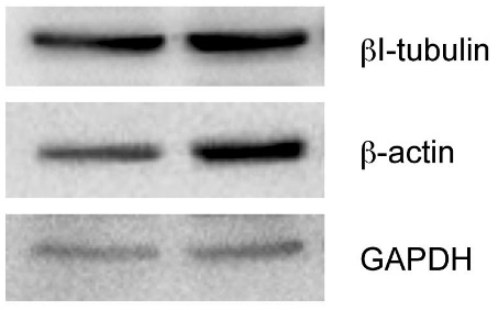WB 高手必知：原来这些实验内参最优不是 β-Actin 或 GAPDH - 企业动态 - 丁香通