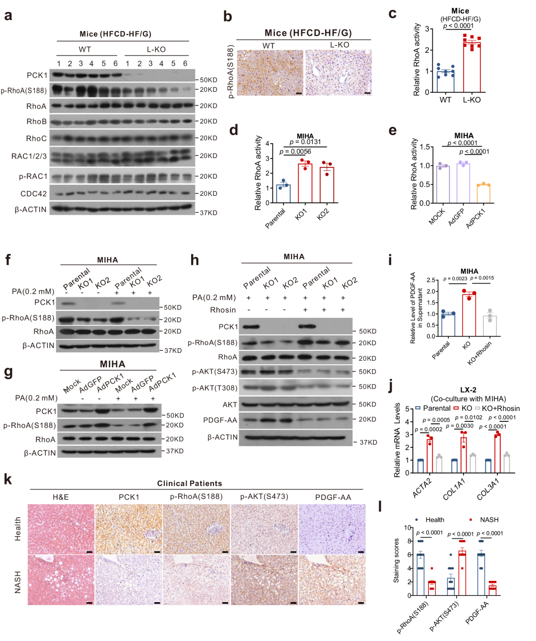 项目文章Nat Commun（IF 17.69）| 重庆医科大学附属第二医院发现糖异生关键酶PCK1调控代谢相关脂肪肝的新机制-公司新闻-上海 ...