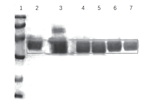 案例分析|重组促红细胞生成素(rhEPO)纯化工艺 - 企业动态 - 丁香通