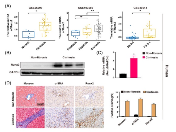 Runx2 通过调节 Itgav 的转录表达激活肝星状细胞来促进肝的纤维化 - 企业动态 - 丁香通