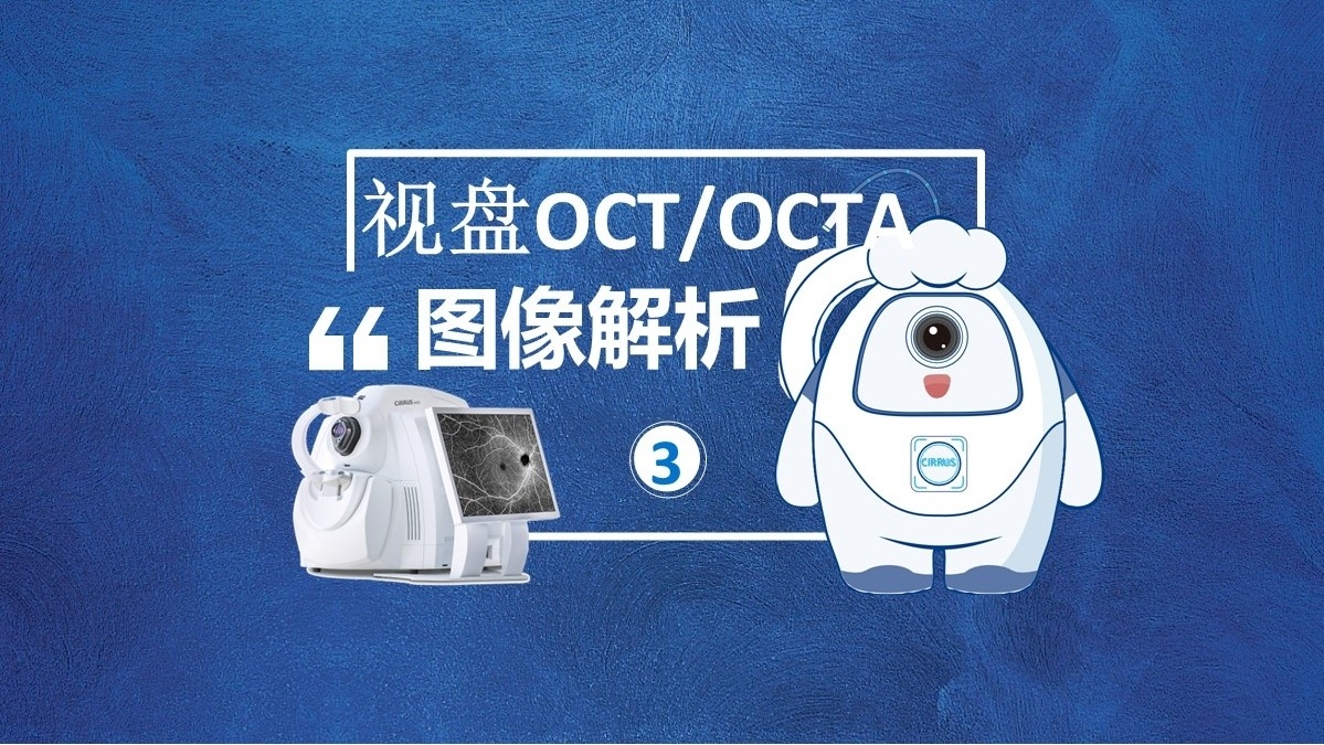 小C趣味OCT（11）｜视盘OCT/OCTA解析第三课