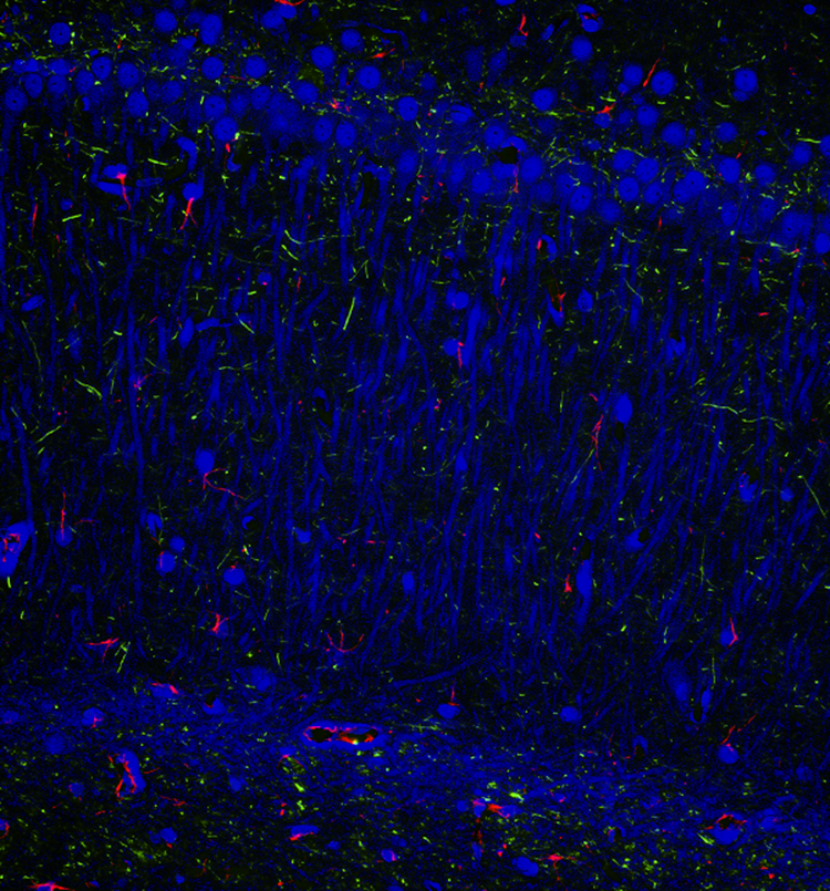 DP75显微数码相机,彩色相机-仪景通光学科技（上海）有限公司