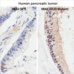 GeneTex重组抗体试用计划-公司新闻-GeneTex