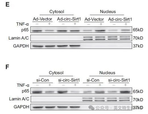 如何用WB验证胞质胞核分离是否成功？-公司新闻-英文特生物技术（北京）有限公司