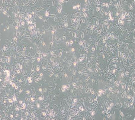 SUM149PT 人乳腺癌细胞传代/复苏技巧 - 企业动态 - 丁香通