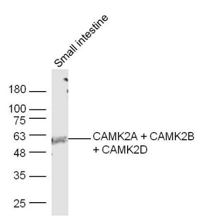 CAMK2A + CAMK2B + CAMK2D钙/钙调素依赖蛋白激酶2b/2γ抗体价格_品牌:LMAI Bio-丁香通官网