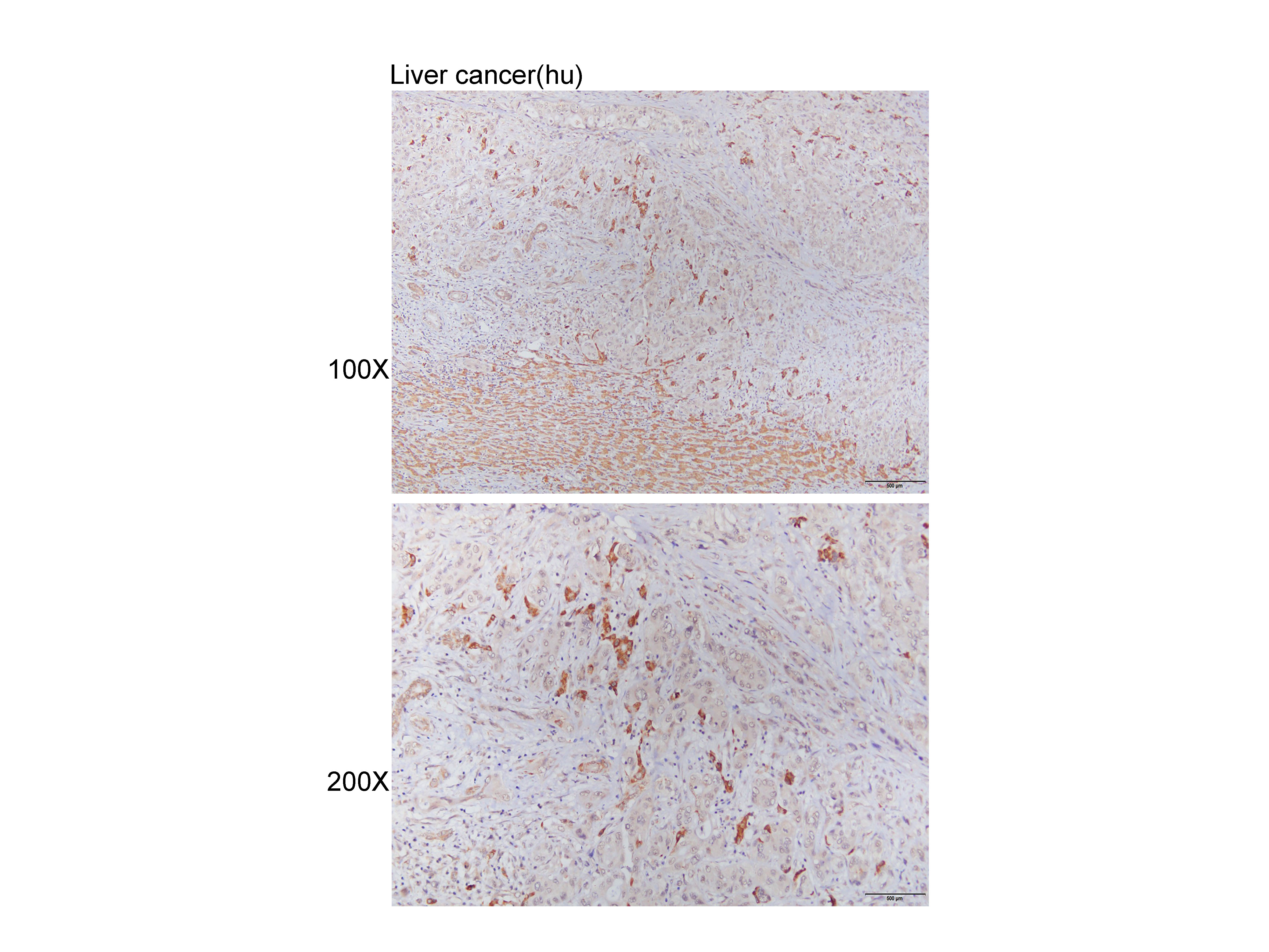 Anti-CD1A Polyclonal Antibody价格_品牌:Solarbio-丁香通官网