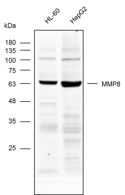 Anti-MMP8 Polyclonal Antibody价格_品牌:Solarbio-丁香通官网