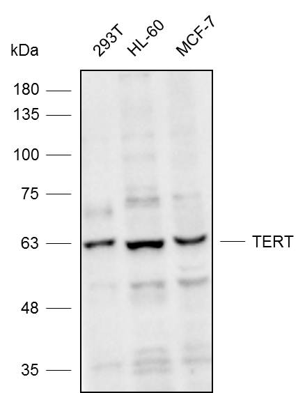 Anti-TERT Polyclonal Antibody价格_品牌:Solarbio-丁香通官网