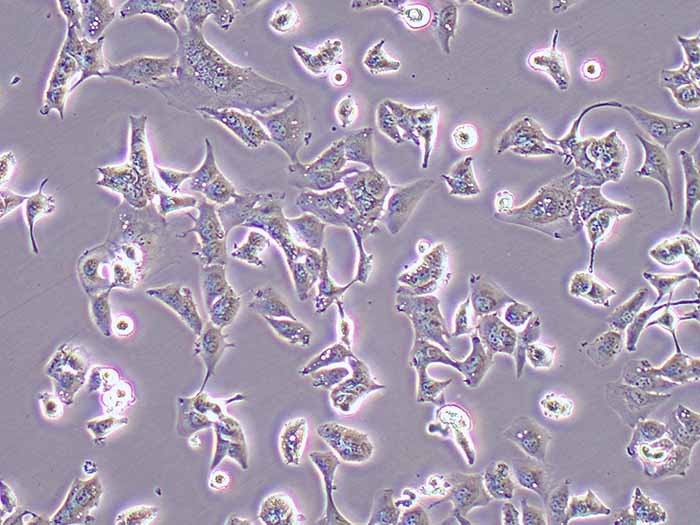 HCC-LM3人高转移肝癌细胞（STR鉴定正确）价格_品牌:博尔森/BIOESN-丁香通官网