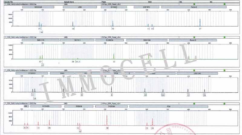 HCC-LM3人高转移肝癌细胞（STR鉴定正确）价格_品牌:博尔森/BIOESN-丁香通官网