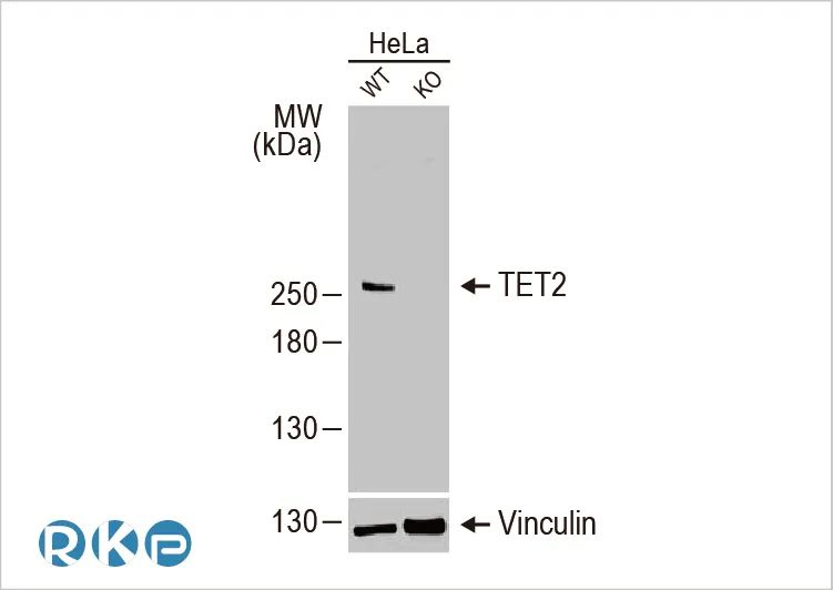 重要发现: TET2 诱导的蛋白酶体降解导致非小细胞肺癌对 EGFR 酪氨酸激酶抑制剂产生耐药性 - 企业动态 - 丁香通