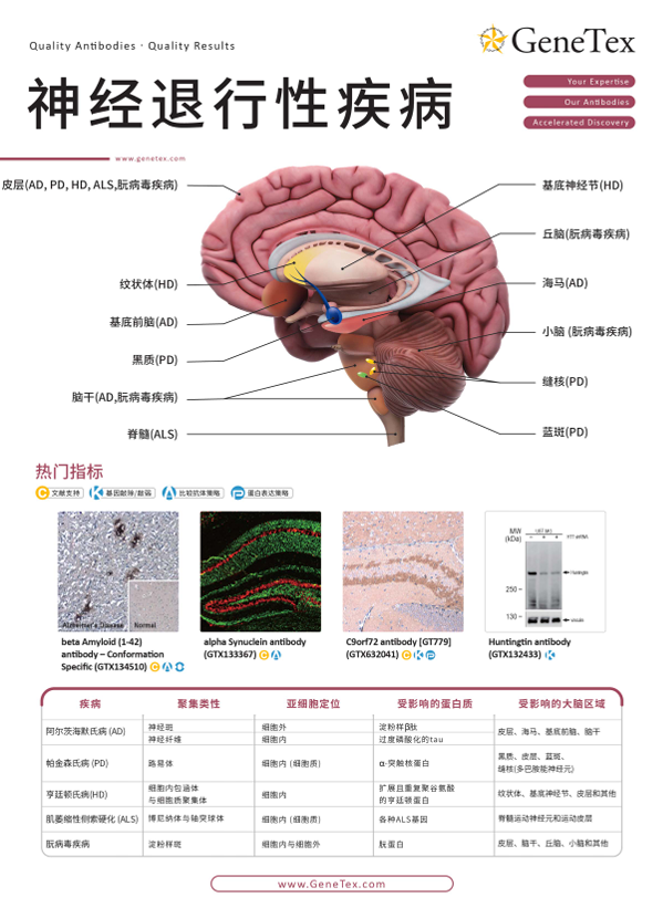 重要发现: 反应性星形胶质细胞分泌的 HSPB1 对阿尔茨海默氏病具有神经保护作用-公司新闻-GeneTex
