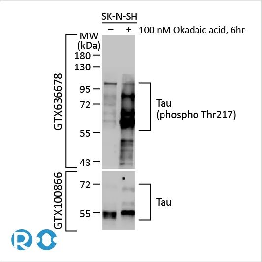 重要发现: 反应性星形胶质细胞分泌的 HSPB1 对阿尔茨海默氏病具有神经保护作用-公司新闻-GeneTex