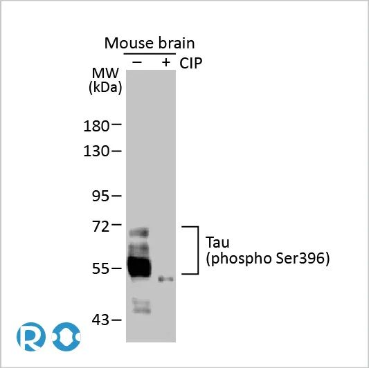 重要发现: 反应性星形胶质细胞分泌的 HSPB1 对阿尔茨海默氏病具有神经保护作用-公司新闻-GeneTex