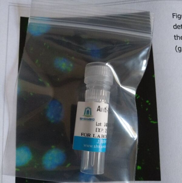 兔抗CD26/DPP4多克隆抗体(WB,IHC,ELISA)价格_品牌:KA&M BIO-丁香通官网