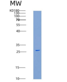 人低氧诱导因子1α(HIF1a)重组蛋白His tag价格_品牌:博尔森生物-丁香通
