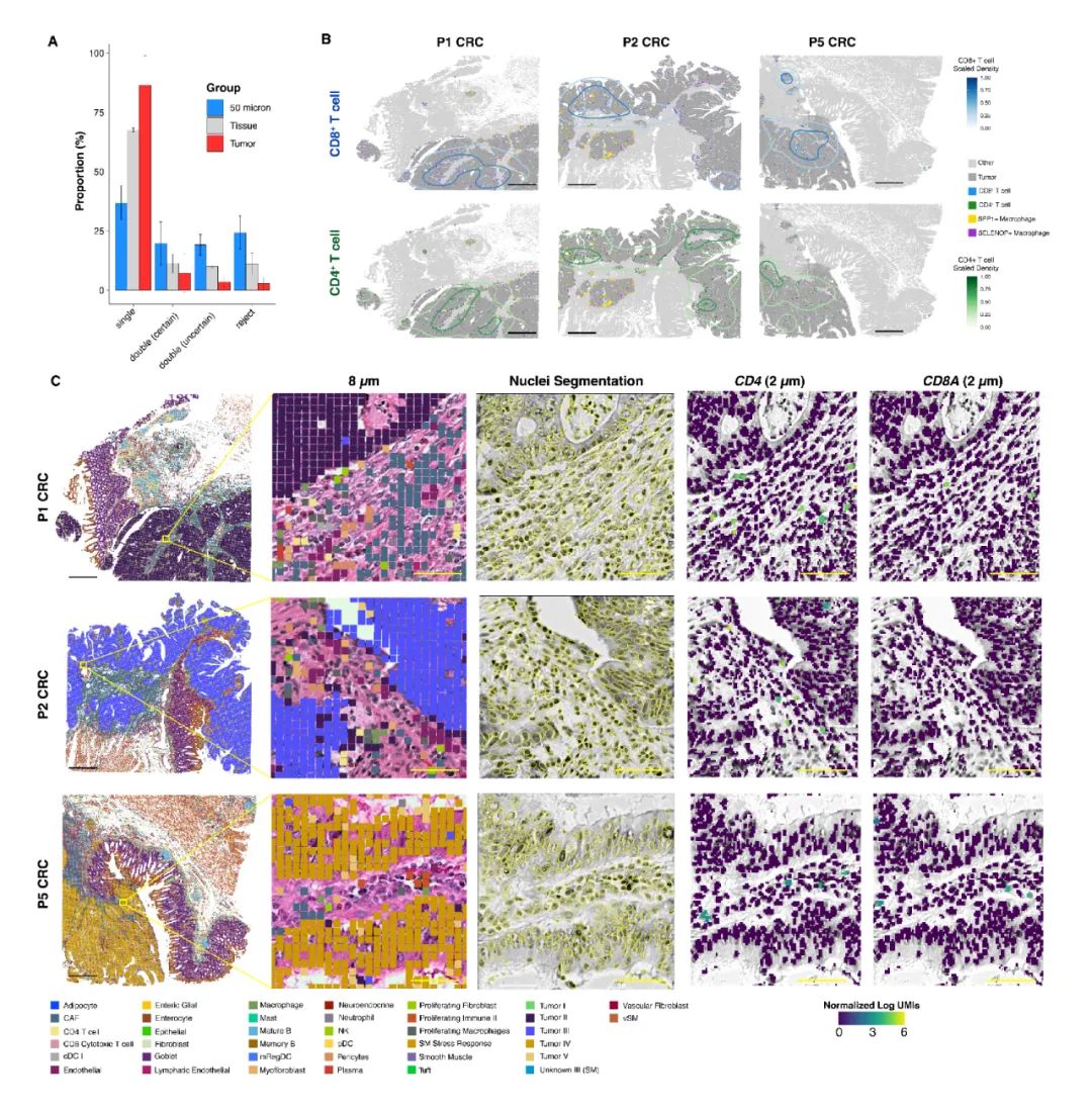 全球首篇Visium HD 文章上线！10x单细胞/空间/原位技术从不同维度相互佐证，助力更多发现！-公司新闻-上海仁科生物科技有限公司