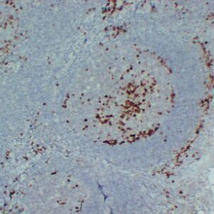 CD38 Mouse mAb价格_品牌:Tanda-丁香通官网