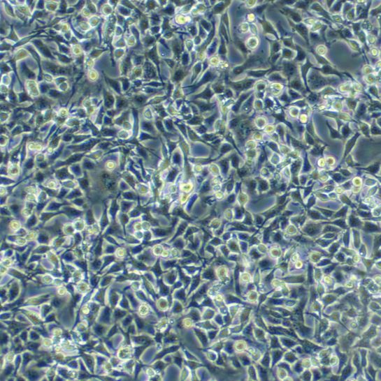 小鼠肝癌细胞H22/LUC(带荧光素酶)价格_品牌:雅吉生物-丁香通官网