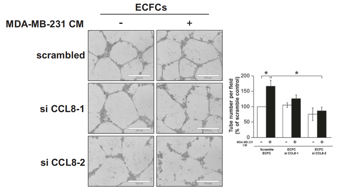CCL8通过IL-8介导内皮细胞集落形成细胞和三阴性乳腺癌细胞之间的串扰，加剧侵袭和致瘤性-技术资料-苏州奎克泰生物技术有限公司