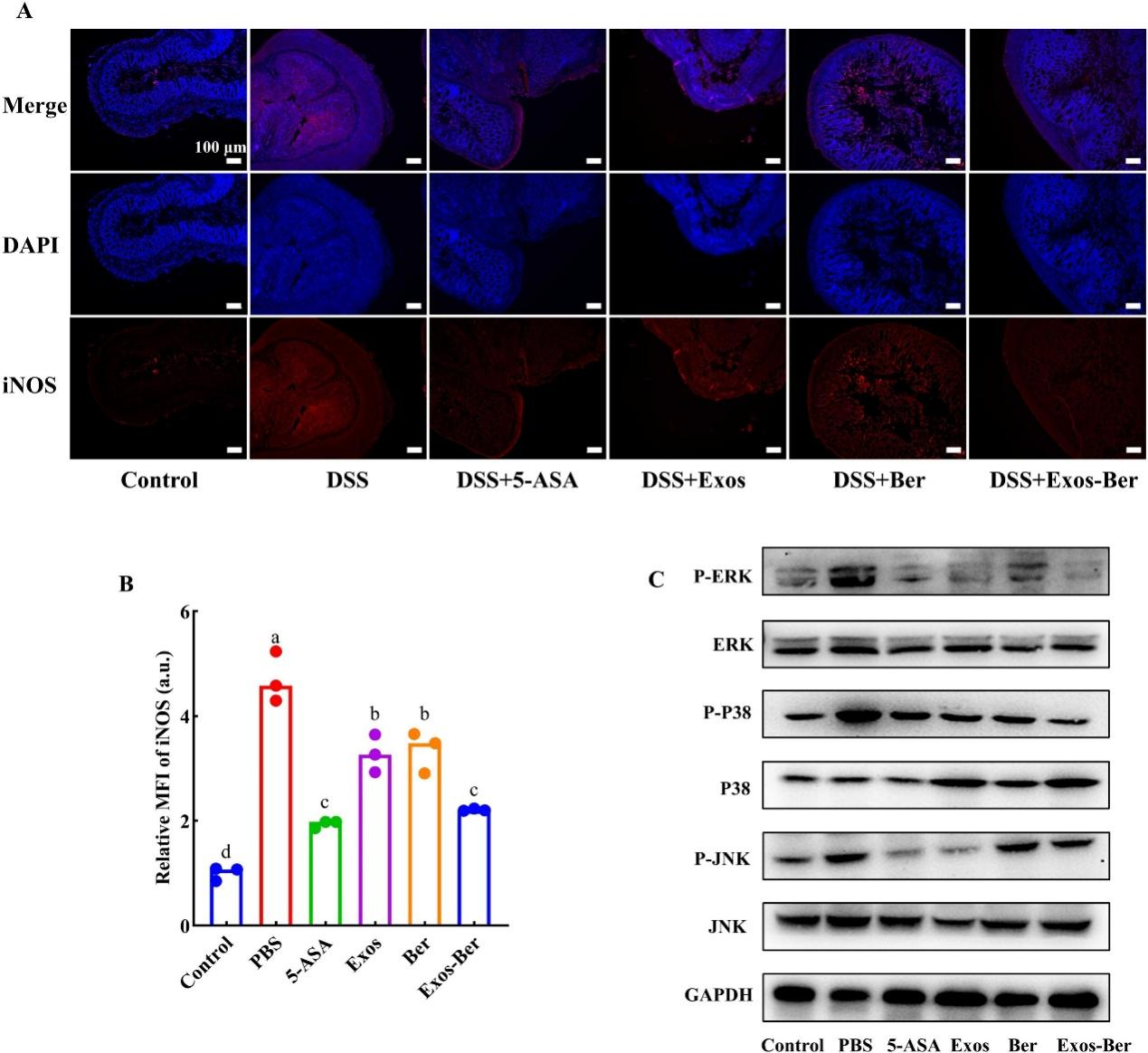 【J COLLOID INTERF SCI】9+，含有小檗碱的间充质干细胞衍生的外泌体用于溃疡性结肠炎治疗-公司新闻-研载生物科技（上海）有限公司