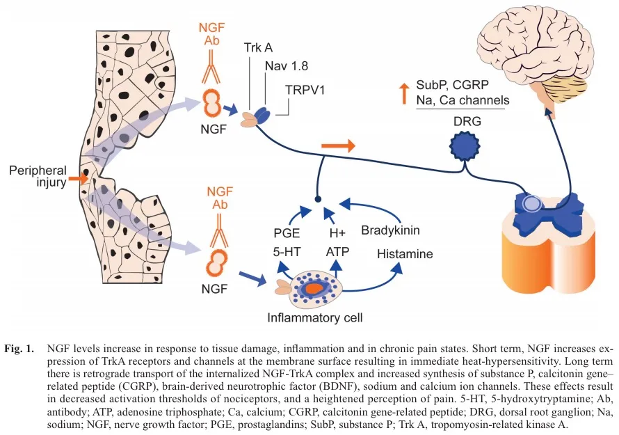 精品推荐 | NGF靶点蛋白助力关节疼痛抗体疗法快速发展 - 企业动态 - 丁香通