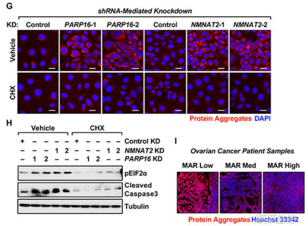Cell. | Polysome profiling技术助力揭示核糖基化修饰与卵巢癌治疗新靶点-公司新闻-广州卿泽生物科技有限公司