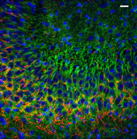 NeuroMab抗半胱氨酸-110/PSD-93抗体（N18/30）促销啦 - 抗体 - 丁香通
