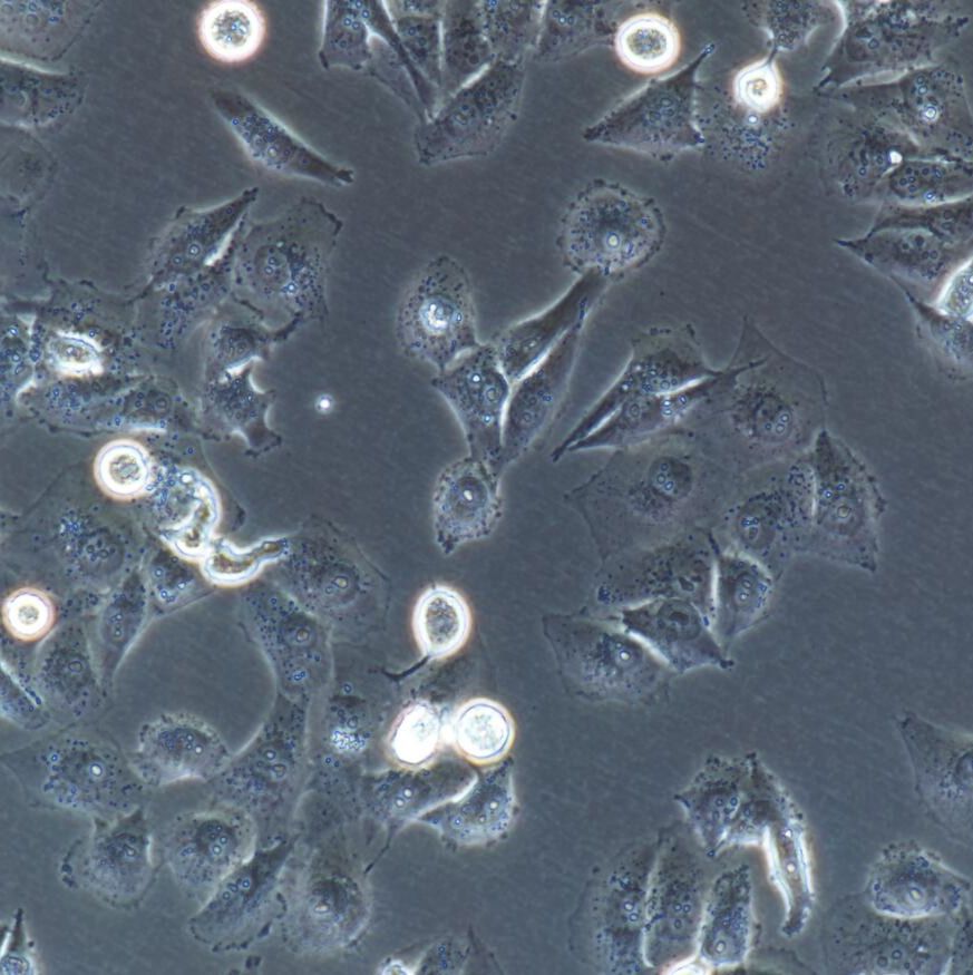 MDA-MB-231 人乳腺癌细胞/MDA-MB-231/MDA-MB-231细胞/STR鉴定/镜像绮点（Cellverse）价格_品牌:iCell（赛百慷）-丁香通