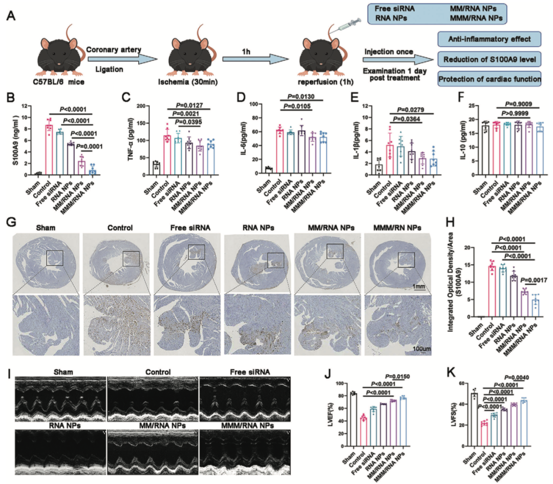 Advanced Science | 工程巨噬细胞膜包裹siRNA改善心肌缺血再灌注损伤-公司新闻-上海吉凯基因医学科技股份有限公司