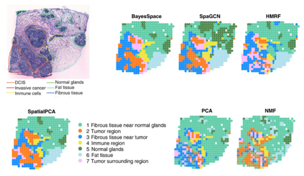 让空间数据分析更简单：数据降维聚类工具——SpatialPCA_公司新闻_上海生物芯片有限公司