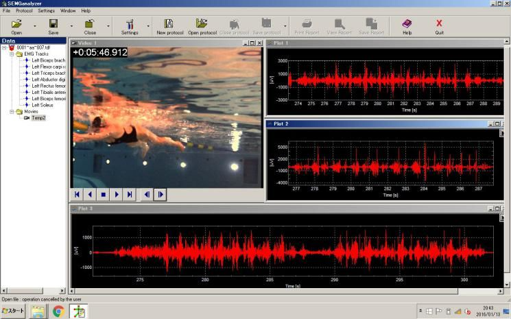 无线表面肌电技术在体育与医学领域中的应用_公司新闻_丁香通
