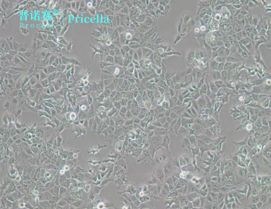 HuH-7人肝癌细胞贴壁培养技巧：如何避免边缘脱落与密度控制-公司新闻-武汉普诺赛生命科技有限公司
