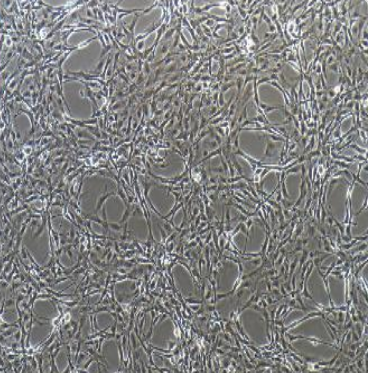 人肾癌细胞；A498 细胞(STR)-公司新闻-上海晶风生物科技有限公司