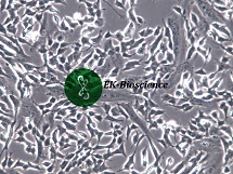 SK-N-SH [SKNSH]人神经母细胞瘤细胞【已通过STR鉴定】-公司新闻-上海酶研生物科技有限公司