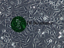 NCI-H1703人肺鳞癌细胞【已通过STR鉴定】-公司新闻-上海酶研生物科技有限公司