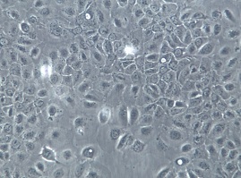 SCC-25；人舌磷癌细胞【已通过STR鉴定】-技术资料-上海酶研生物科技有限公司