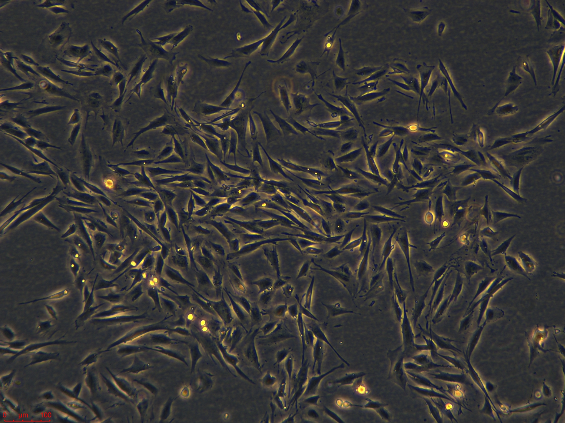 【每日推荐】美森细胞-正常人肠上皮细胞系 HIEC-6-公司新闻-浙江美森细胞科技有限公司