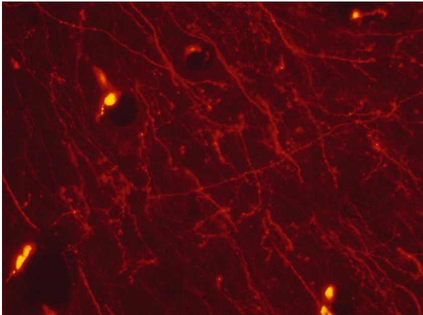 Fluorochrome神经顺行示踪金标准-红色荧光金（Fluoro-Ruby）-公司新闻-北京博蕾德生物科技有限公司