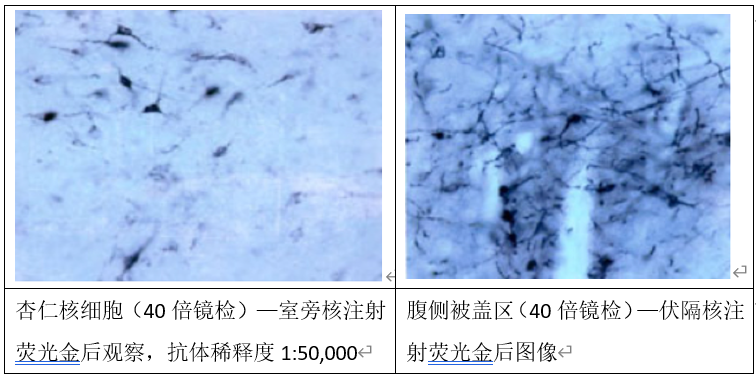 Fluorochrome荧光金抗体(Antibody to Fluoro-Gold)-行业标准-公司新闻-北京博蕾德生物科技有限公司