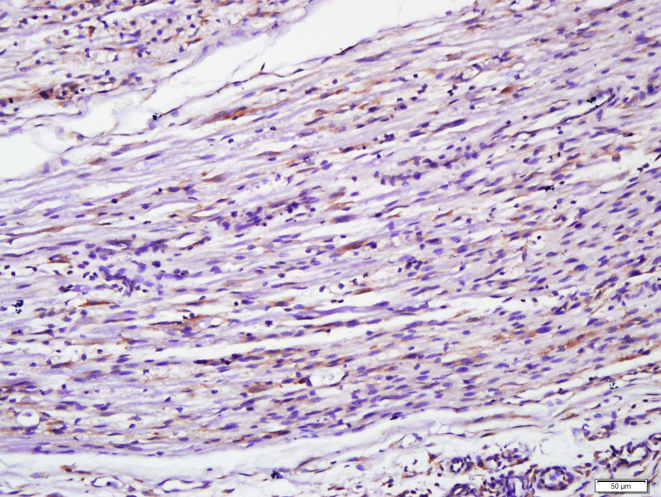 MyD88 Rabbit pAb(bs-1047R)-50ul/100ul/200ul价格_品牌:Bioss-丁香通