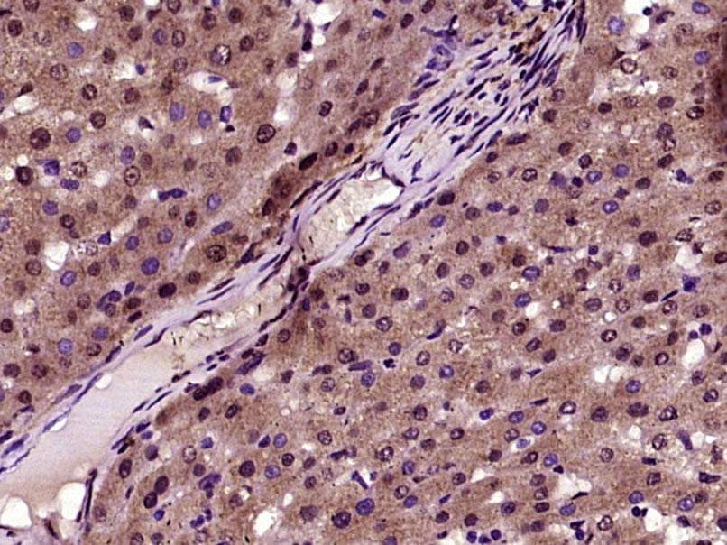 ZNF692 Rabbit pAb(bs-4360R)-50ul/100ul/200ul价格_品牌:Bioss-丁香通