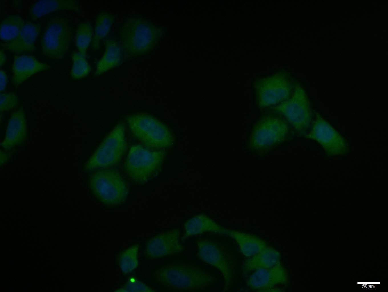 phospho-IKK alpha/beta (Ser176 + Ser180) Rabbit pAb(bs-3237R)-50ul/100ul/200ul价格_品牌:Bioss-丁香通