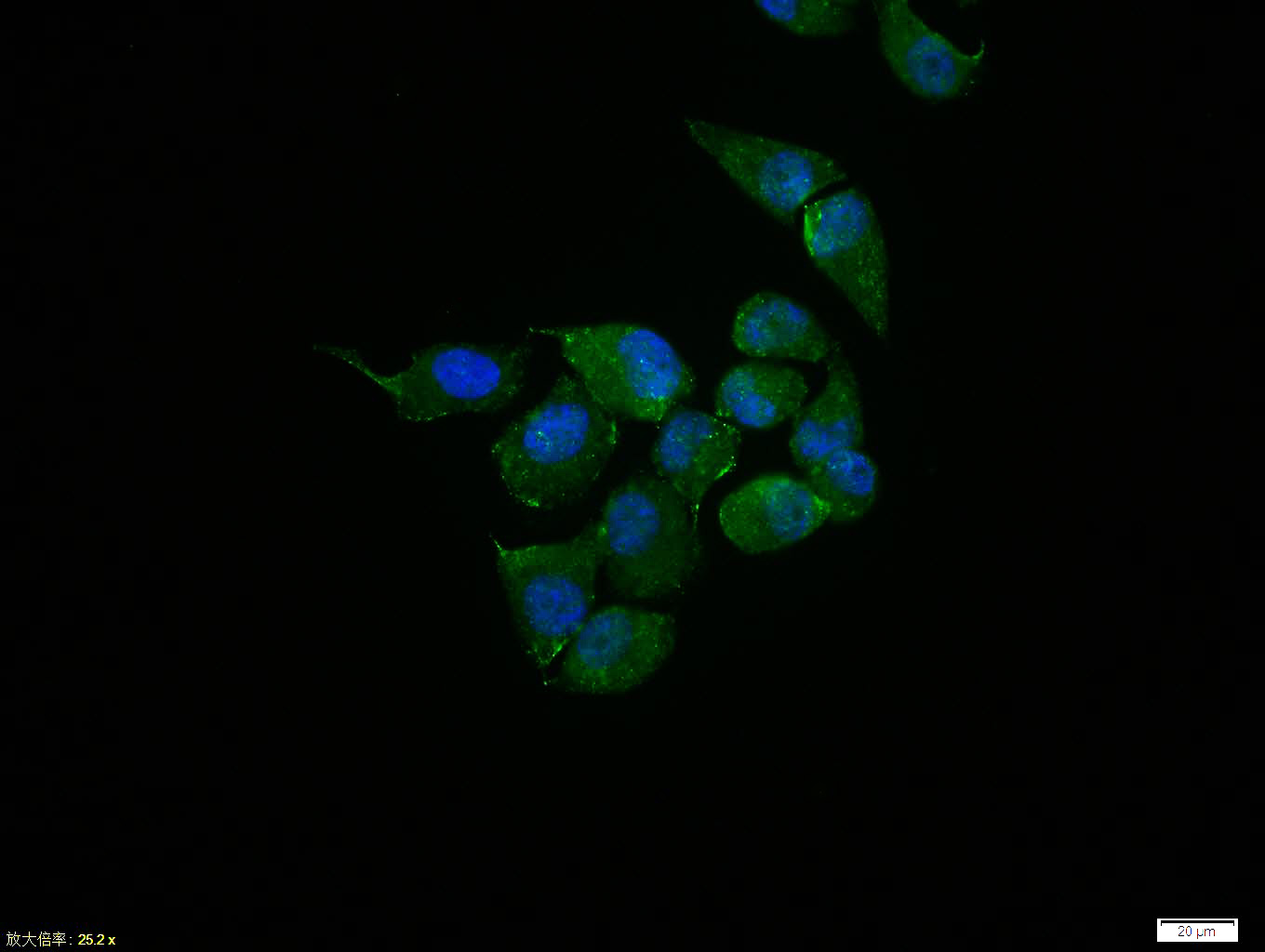 Galectin 3 Rabbit pAb(bs-20699R)-50ul/100ul/200ul价格_品牌:Bioss-丁香通